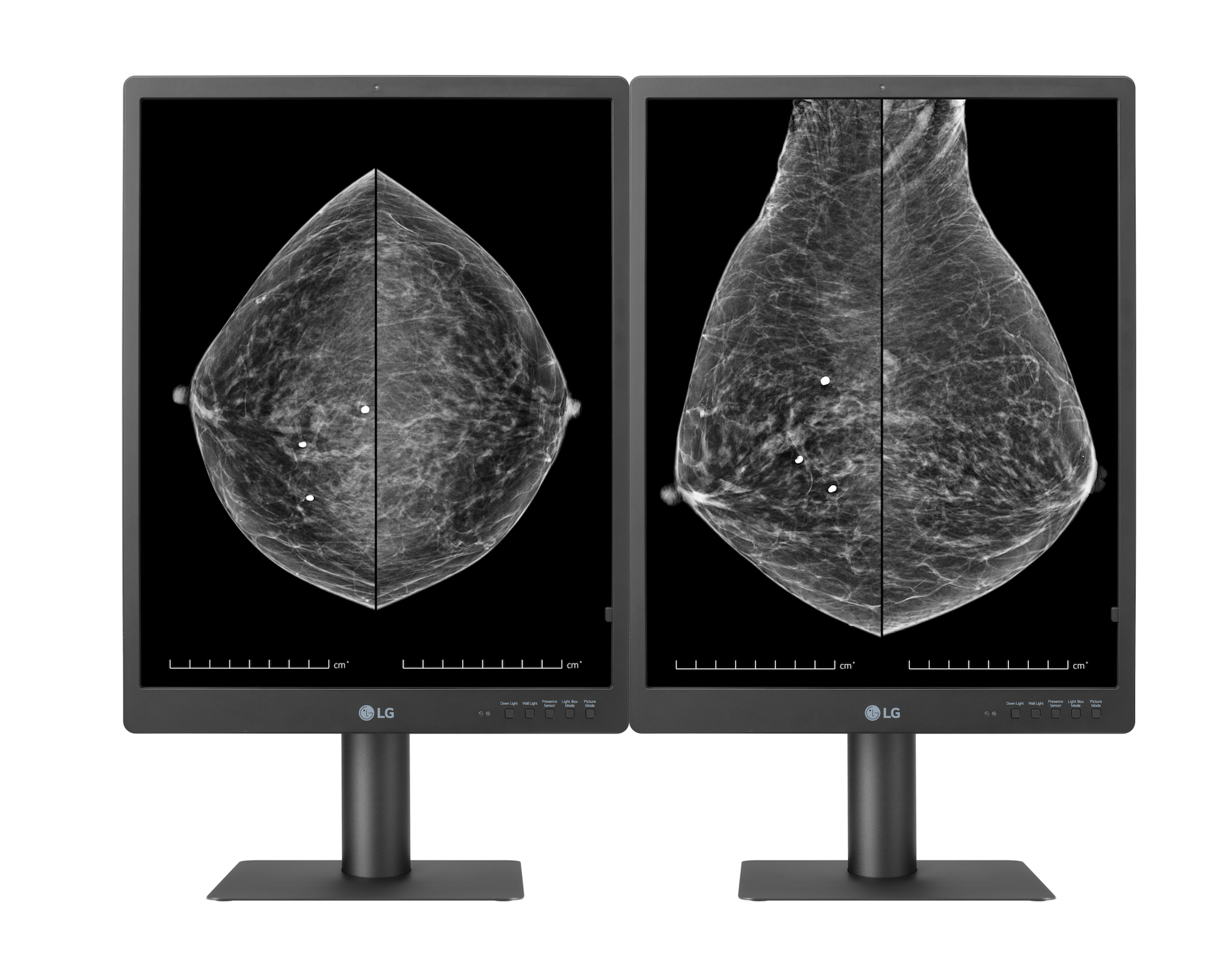 LG launches 5MP diagnostic monitor for breast imaging - Installation